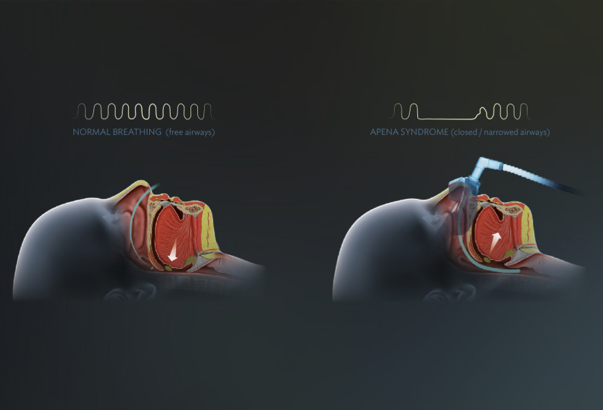 Breaze – Prototypes for Humanity