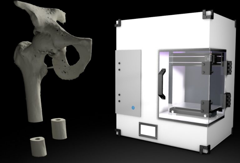 Swift – at home prosthetic leg – Prototypes for Humanity