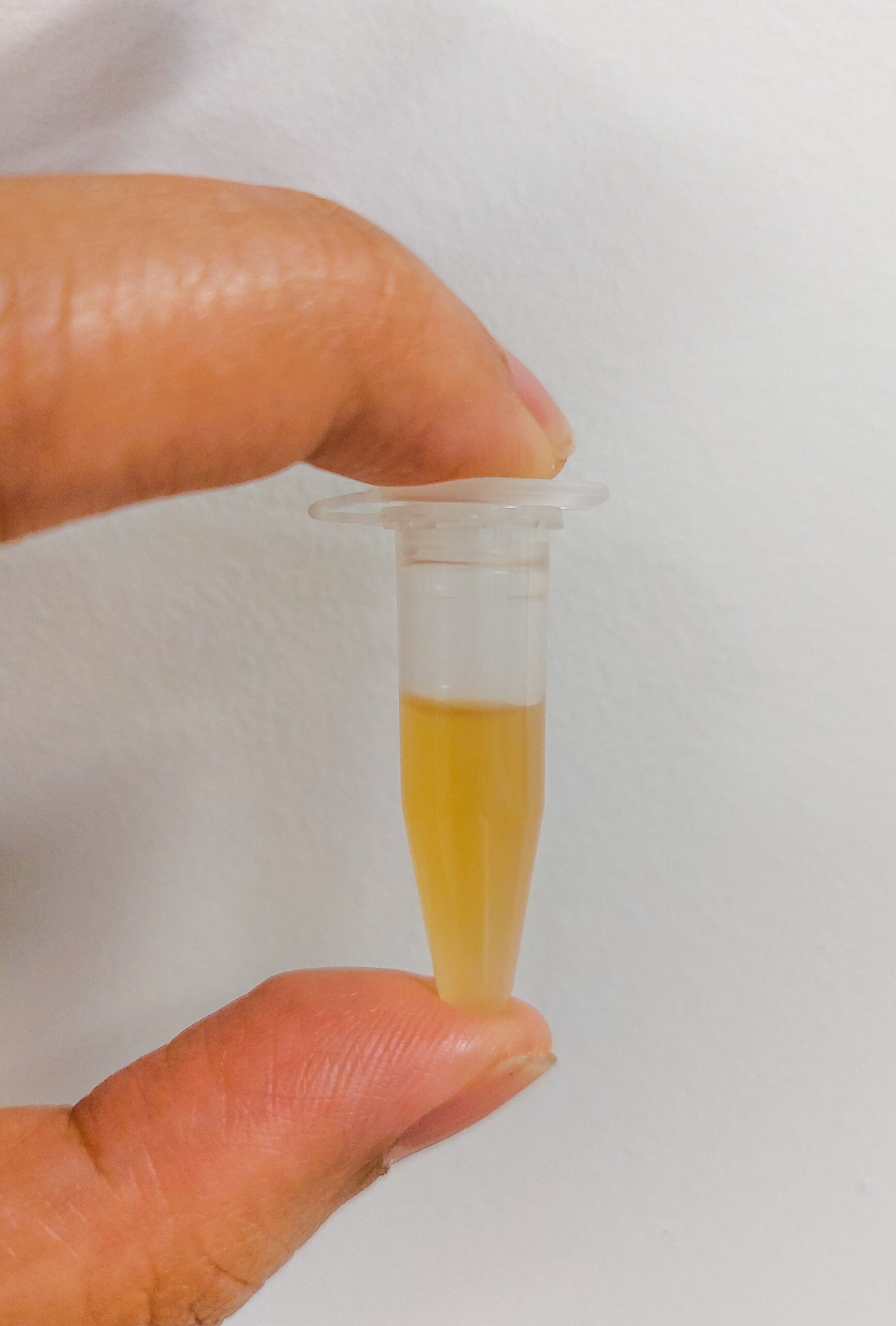 Nanoparticles Against Cancer - Prototypes for Humanity