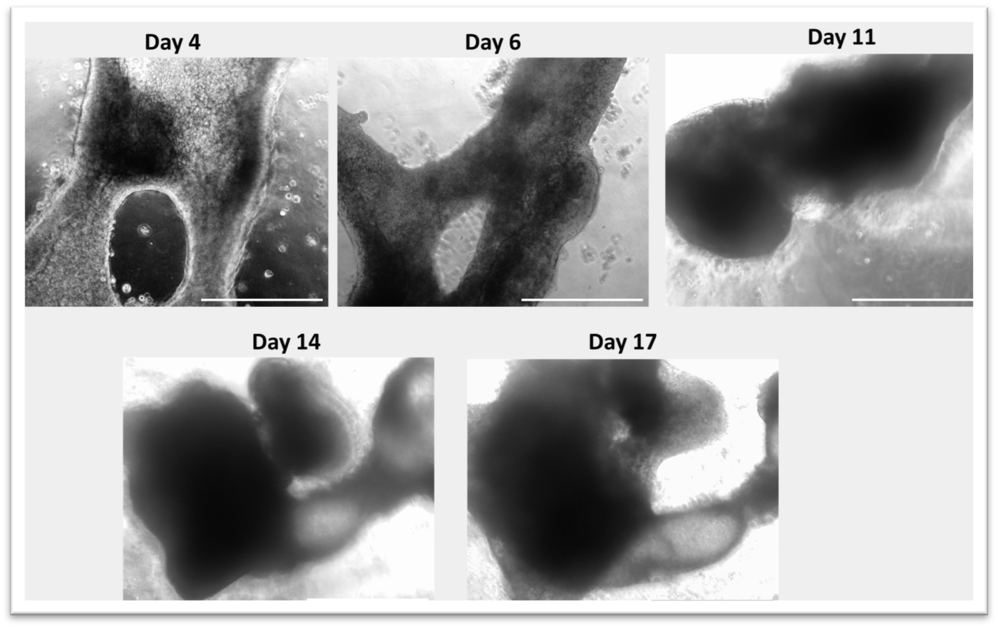 Heterogenous Lung Organoids – Prototypes for Humanity