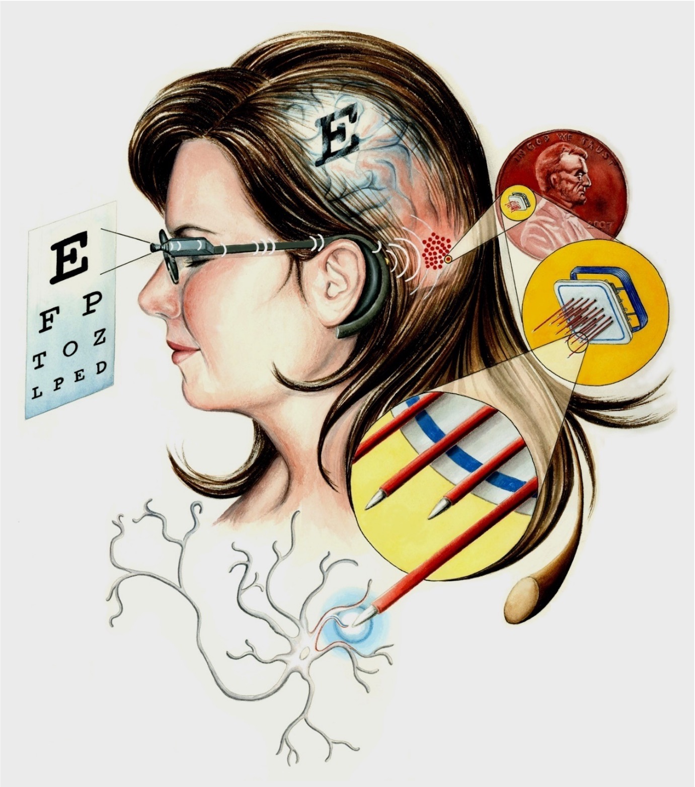 Intracortical visual prosthesis - Prototypes for Humanity