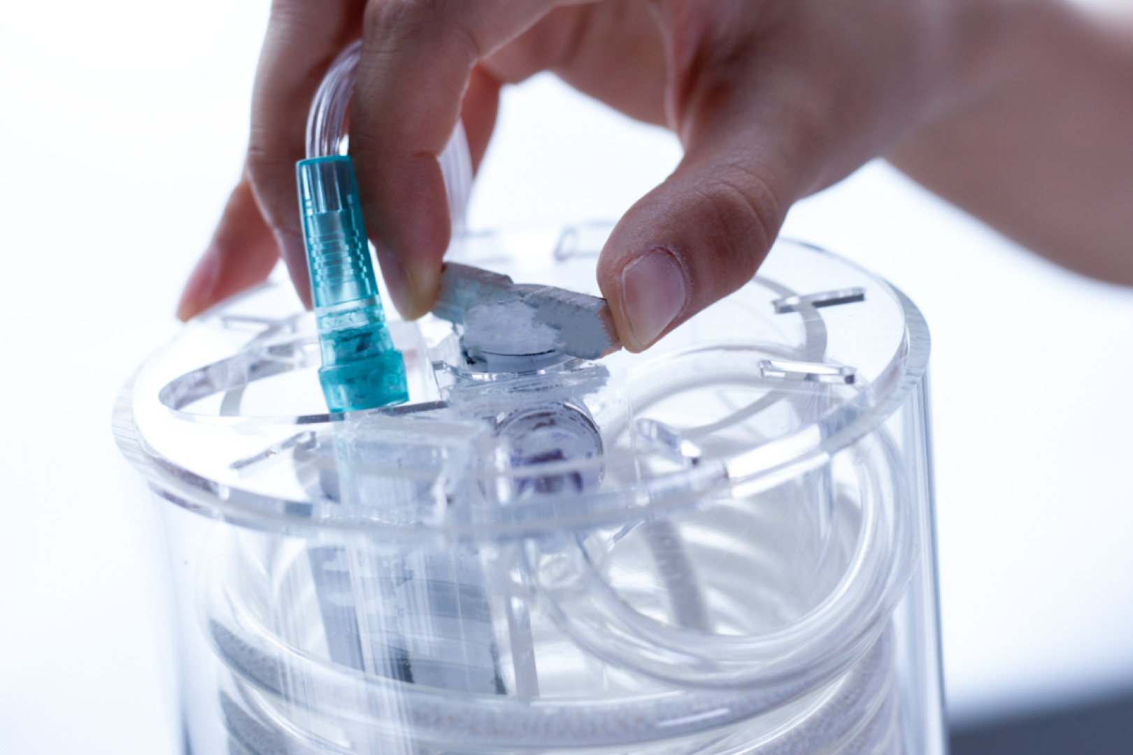 Oxynizer – Prototypes for Humanity